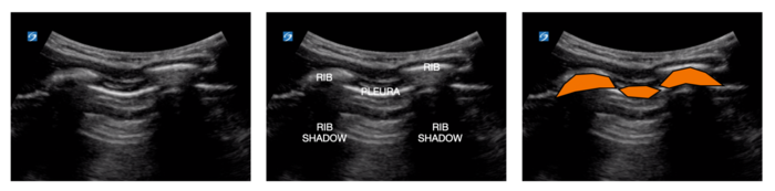 Standard Views :: POCUS
