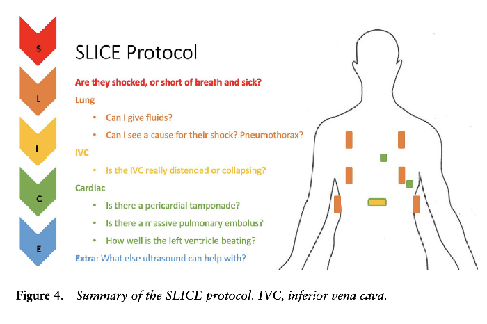 SLICE :: POCUS